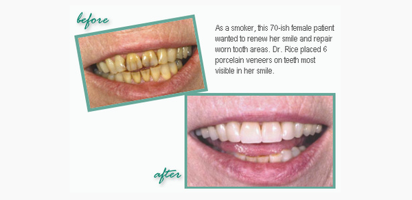 DAVID A RICE, DDS - Updated October 2025 - 38 Photos & 24 Reviews ...