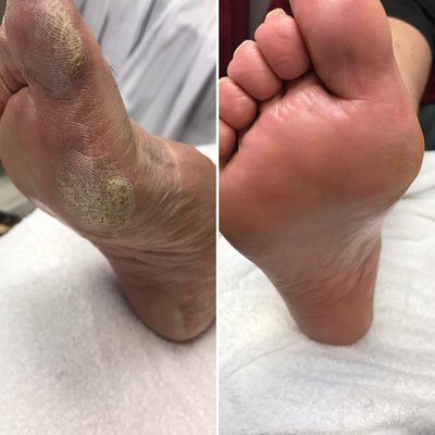 MEDITRIM TOENAIL HEALTH - Updated March 2025 - 11 Photos - 13131 ...