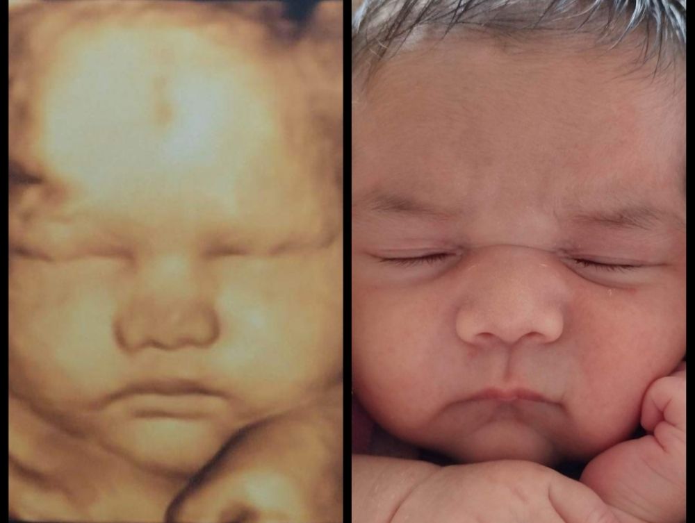 A LITTLE INSIGHT 3D 4D 5D ULTRASOUND - 540 Photos & 332 Reviews - 190 S ...