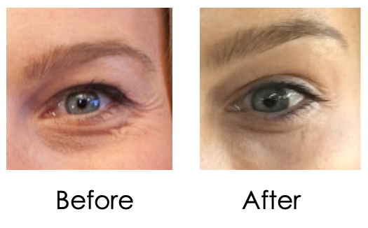 AVA KHOSRAVIANI, MD, FAAD - SKINWELL DERMATOLOGY - Updated January 2026 ...