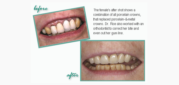 DAVID A RICE, DDS - Updated October 2025 - 38 Photos & 24 Reviews ...