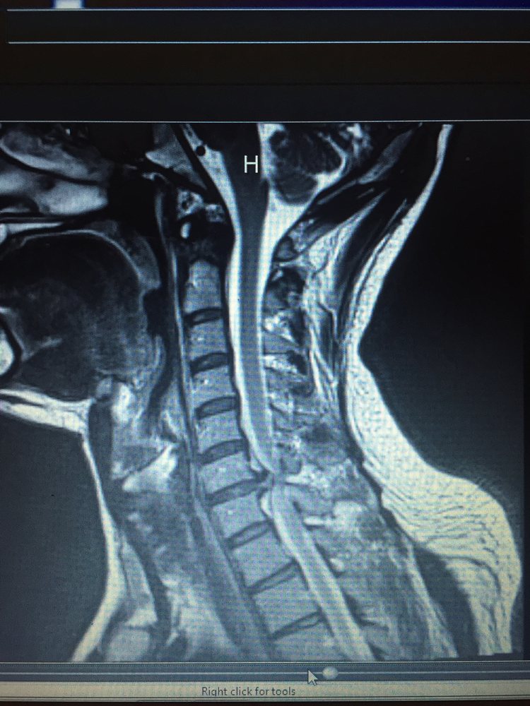 RAMIN RAISZADEH, MD - SPINE AND BRAIN INSTITUTE OF SAN DIEGO - Updated ...