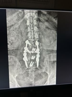 ALIGN SPINE CENTER - Updated June 2026 - 61 Reviews - 2720 N Harbor ...