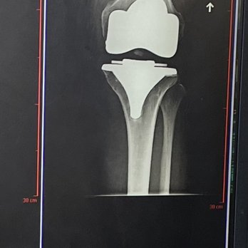 MICHAEL VERCILLO, MD - Updated December 2025 - 58 Reviews - 375 Rolling ...