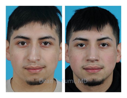DEAN TORIUMI, MD - Updated May 2026 - 58 Photos & 50 Reviews - 60 E ...
