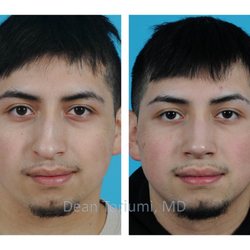 DEAN TORIUMI, MD - 45 Photos & 31 Reviews - 60 E Delaware Pl, Chicago ...