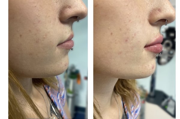 ALOHA LASER AESTHETICS - Updated August 2025 - 27 Photos & 38 Reviews ...