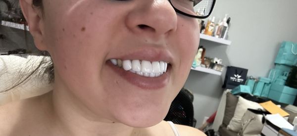 DENTAL DESIGN SMILE - Updated December 2025 - 48 Photos & 58 Reviews ...