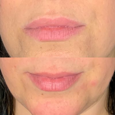 MIDSTATE SKIN INSTITUTE - Updated December 2025 - 34 Photos & 15 ...