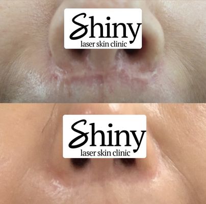 SHINY LASER SKIN CLINIC - Updated December 2025 - 142 Photos & 577 ...