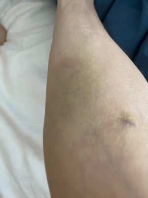 LABCORP - Updated January 2026 - 24 Photos & 38 Reviews - 115 E 57th St ...