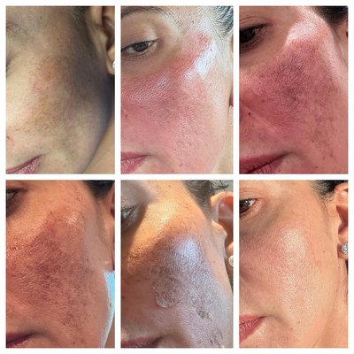 HEALTHY GLOW AESTHETICS - Updated October 2024 - Request an Appointment - 15 Photos - 2821 E ...