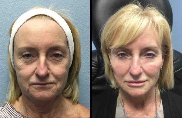 MIDSTATE SKIN INSTITUTE - Updated December 2025 - 34 Photos & 15 ...