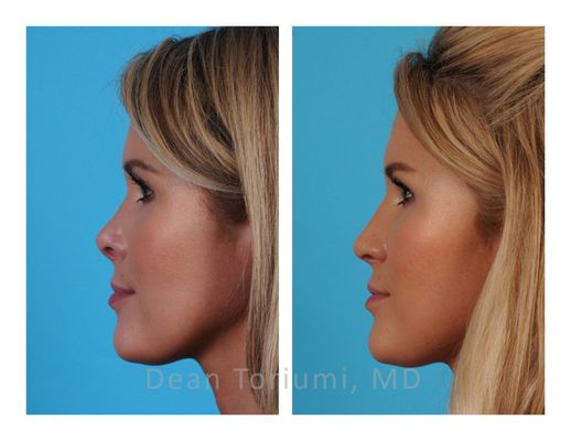 DEAN TORIUMI, MD - Updated September 2025 - 68 Photos & 48 Reviews - 60 ...