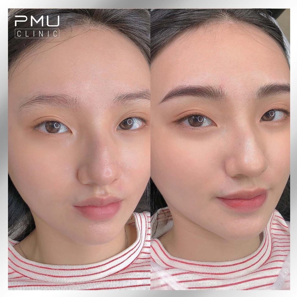 PMU CLINIC - Updated April 2025 - 330 Photos - 2365 Quimby Rd, San Jose ...