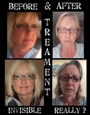 PACIFIC GROVE HOSPITAL - Updated May 2025 - 34 Photos & 86 Reviews ...