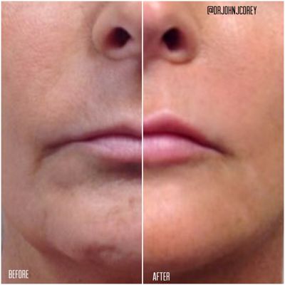 JOHN J. COREY, MD - AESTHETIC PLASTIC SURGERY - Updated January 2026 ...