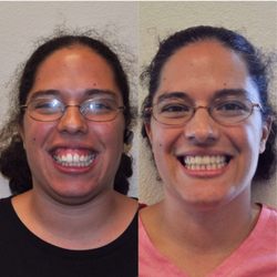 General Dentistry - PURE DENTAL OF MURRIETA & ORTHODONTICS - 69 Photos & 121 Reviews - 40585 ...