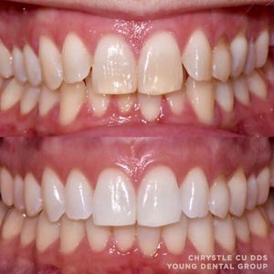 JENNIFER LEE, DDS - Updated July 2024 - 33 Reviews - 324 N San Mateo Dr ...