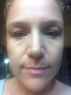 DUSTIN HERINGER, MD-ARIZONA OCULAR AND FACIAL PLASTIC SURGERY - Updated ...