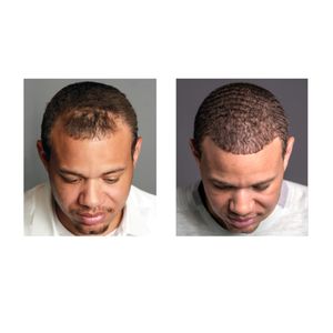 ADVANCED HAIR RESTORATION - Updated June 2025 - 68 Photos & 37 Reviews ...