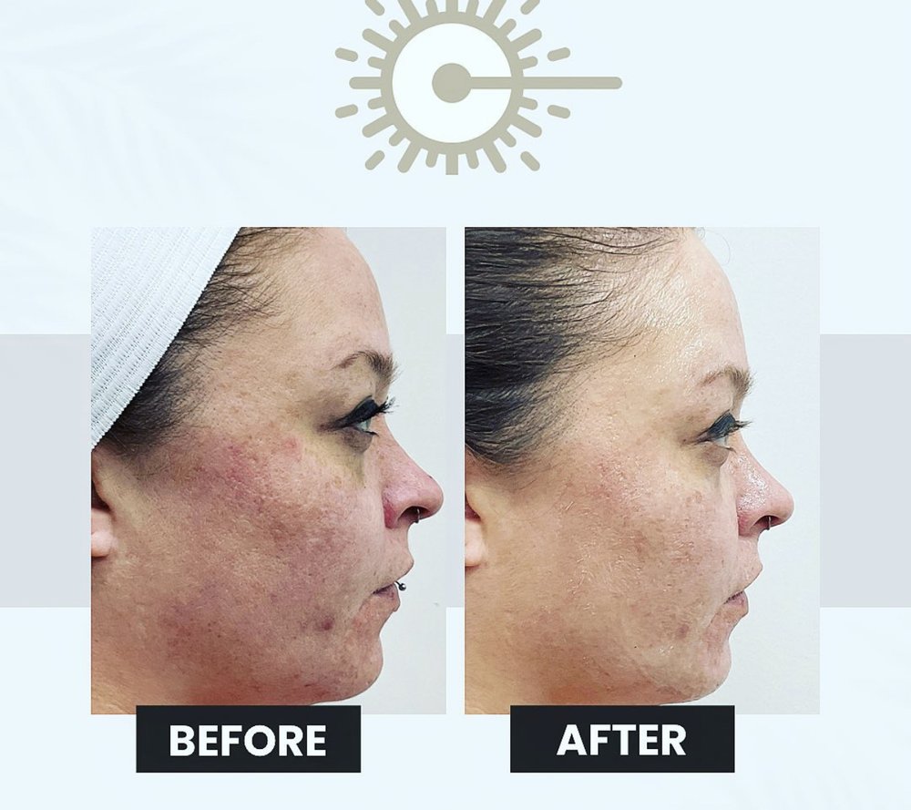 CONFIDENT MED SPA - Updated December 2025 - 100 Photos - 31 Fresh River ...