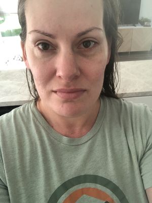 GUY MASSRY, MD - Updated December 2025 - 154 Photos & 176 Reviews - 150 ...