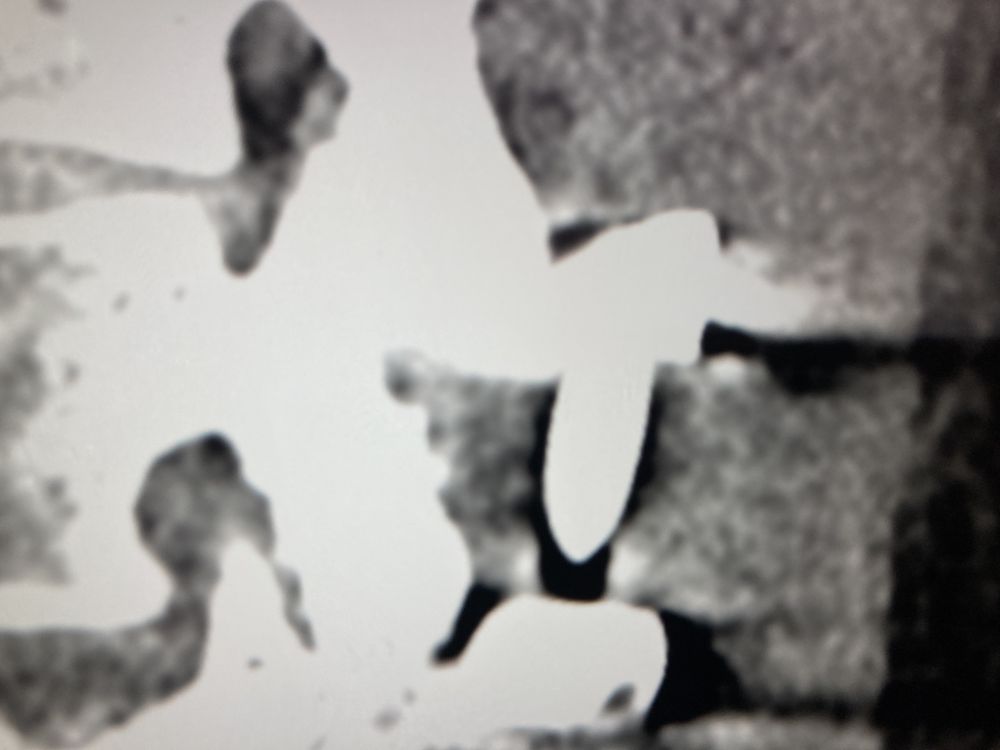 GORDON TANG, MD - EAST BAY NEUROSURGERY & SPINE - Updated December 2025 ...