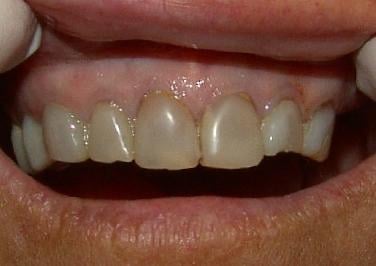 MARK A BARBER, DDS - Updated December 2025 - 11 Photos - 718 SE Becker ...