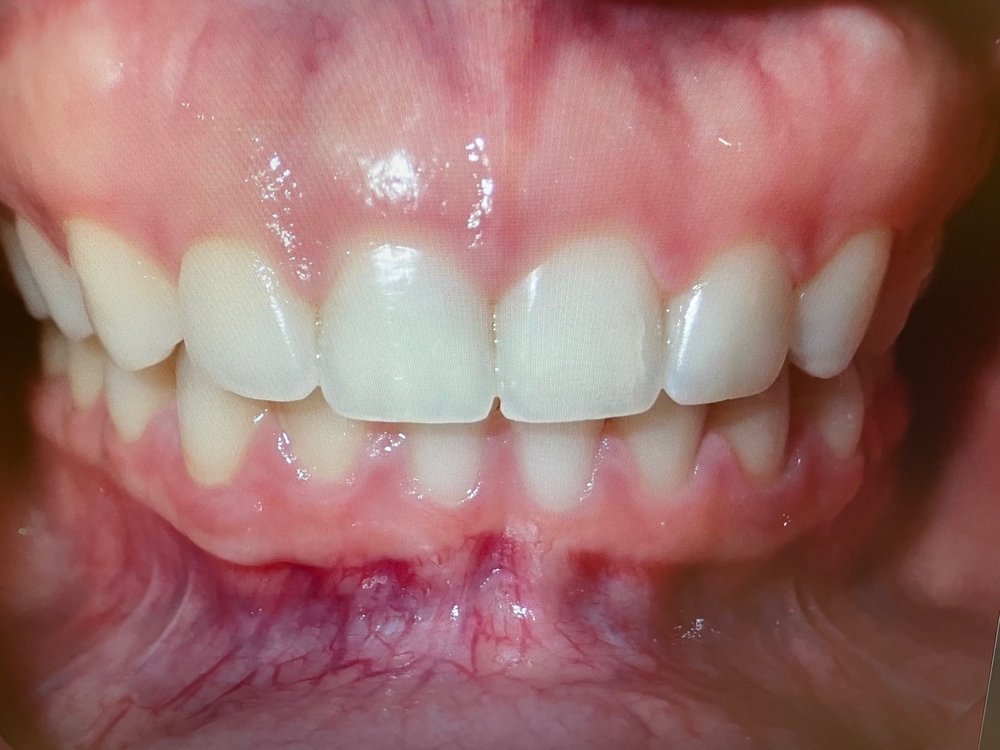 ADVANCED PERIO ENDO EXPERTS - Updated December 2025 - 13 Photos & 15 ...