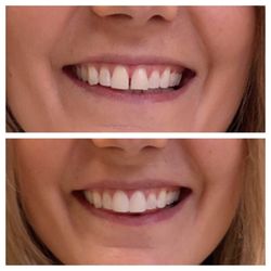 CHICAGO STYLE SMILES - 35 Photos & 150 Reviews - 30 N Michigan Ave ...