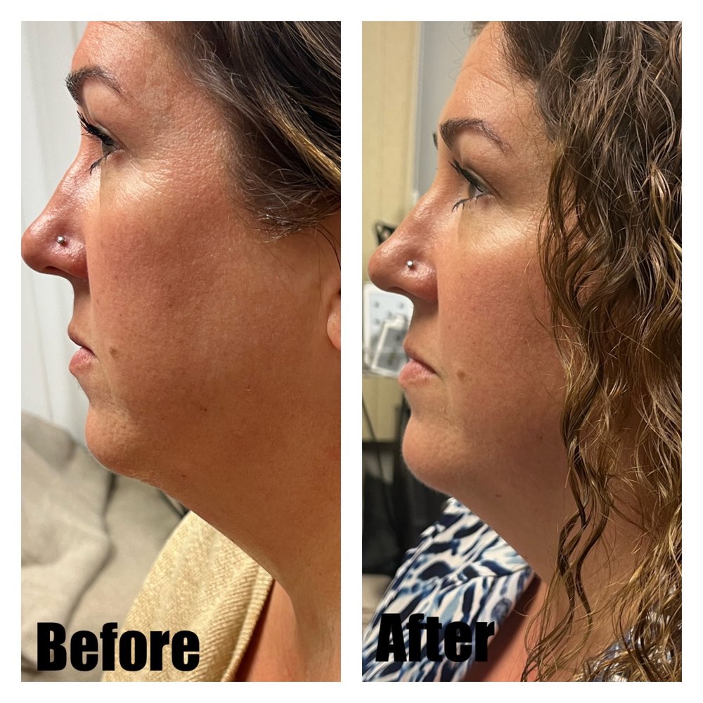 JEALOUSY BODY SCULPTING - 18 Photos - 1314 Hooper Ave, Toms River, New ...