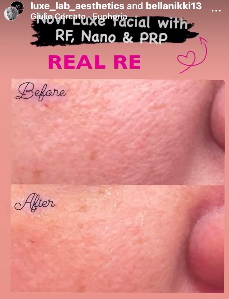 LUXE LAB AESTHETICS - Updated June 2025 - Request an Appointment - 2301 Del Prado Blvd S, Cape ...