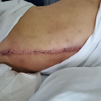 PENTUCKET MEDICAL: EXPRESSCARE RIVERWALK - Updated January 2026 - 29 ...