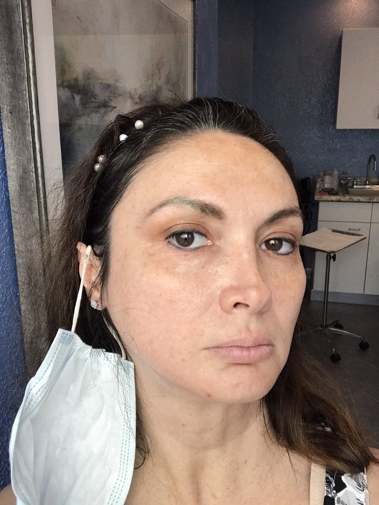Glo Skin Spa Updated September 2024 25 Photos 933 First Colonial Rd Virginia Beach