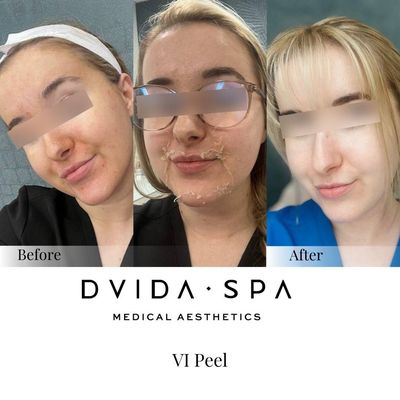 DVIDA MED SPA - Updated December 2025 - 164 Photos & 293 Reviews - 677 ...