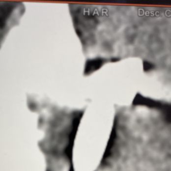 GORDON TANG, MD - EAST BAY NEUROSURGERY & SPINE - Updated December 2025 ...