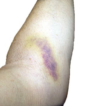 LABCORP - Updated October 2025 - 1785 Route 9, Clifton Park, New York ...