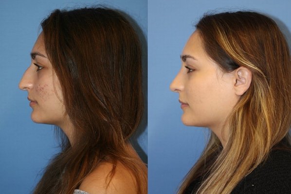 EVAN RANSOM, MD - Updated December 2025 - 126 Photos & 241 Reviews ...