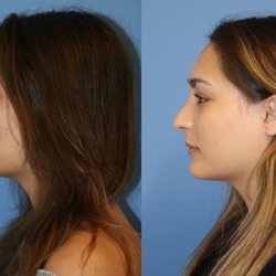 EVAN RANSOM, MD - 123 Photos & 171 Reviews - Cosmetic Surgeons - 450 ...