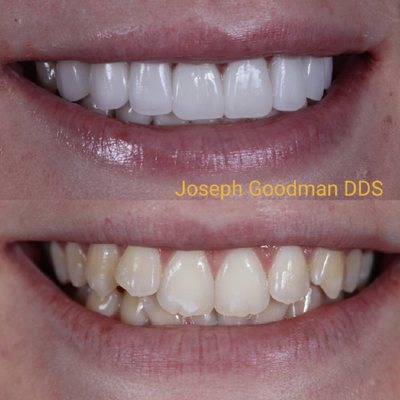JOSEPH GOODMAN, DDS, DMD - Updated December 2024 - 113 Photos & 143 ...