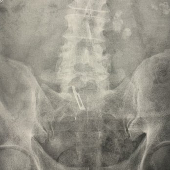 LIJ VALLEY STREAM - Updated September 2025 - 31 Reviews - 900 Franklin ...