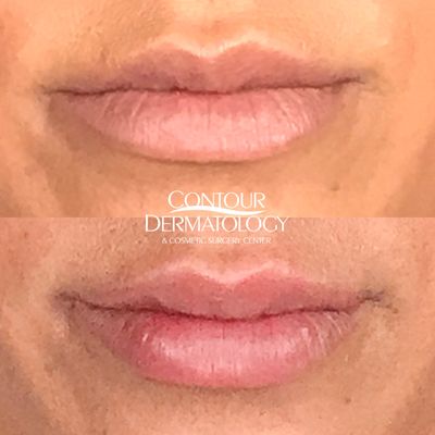 CONTOUR DERMATOLOGY & COSMETIC SURGERY CENTER - 38 Photos & 114 Reviews ...