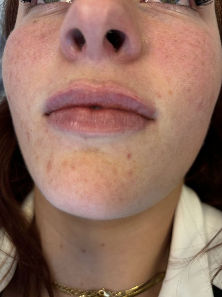 LAVISH AESTHETICS - Updated December 2024 - Request an Appointment - 43 ...