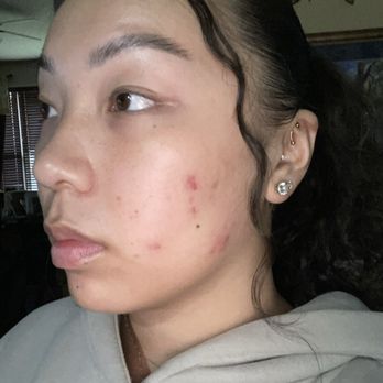 DERMASPACE - Updated December 2025 - 74 Photos & 178 Reviews - 509 ...