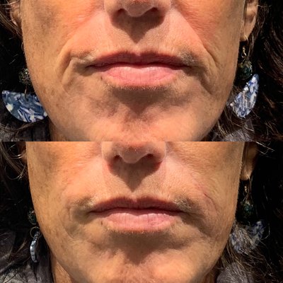 ATLANTA MEDICAL AESTHETICS - 65 Photos & 54 Reviews - 77 12th St NE ...