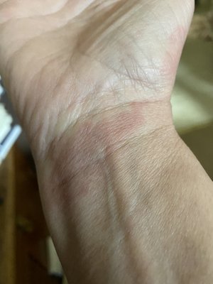 COMMONSPIRIT PENROSE HOSPITAL - Updated March 2025 - 28 Photos & 123 ...