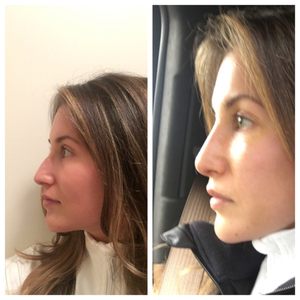 MANOLIS MANOLAKAKIS, DMD, FACS - ADVANCED FACIAL SURGERY - 12 Reviews ...