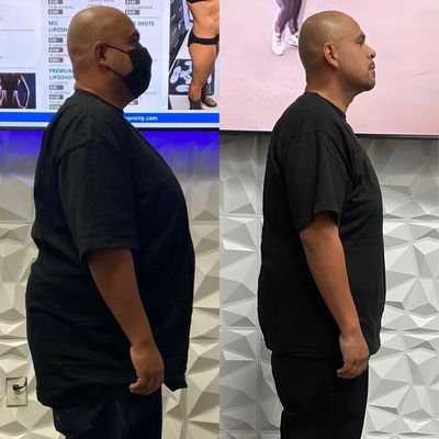 VANEITY MEDICAL WEIGHT LOSS - Updated September 2024 - 519 Photos & 237 ...