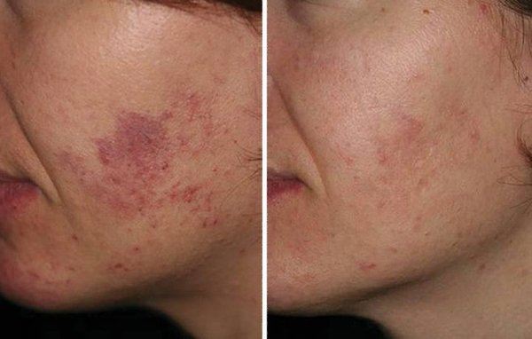 DERMATOLOGY & SKIN CARE ASSOCIATES - Updated December 2025 - 26 Reviews ...